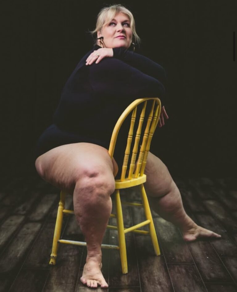 Guylaine Guay annonce qu’elle souffre d’une maladie chronique - Vedette Québec