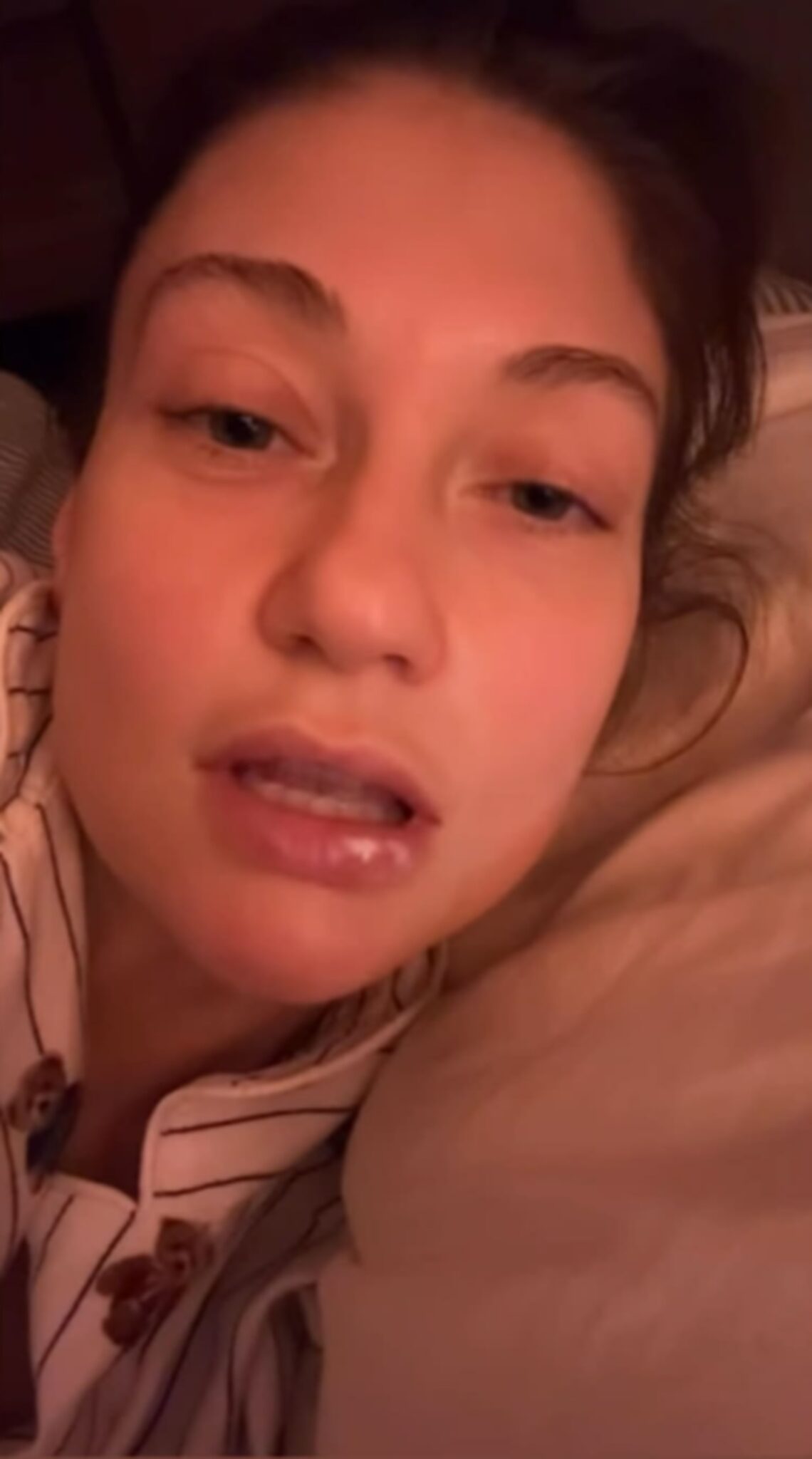 Katherine Levac montre sa réaction allergique aux lèvres et c'est ...